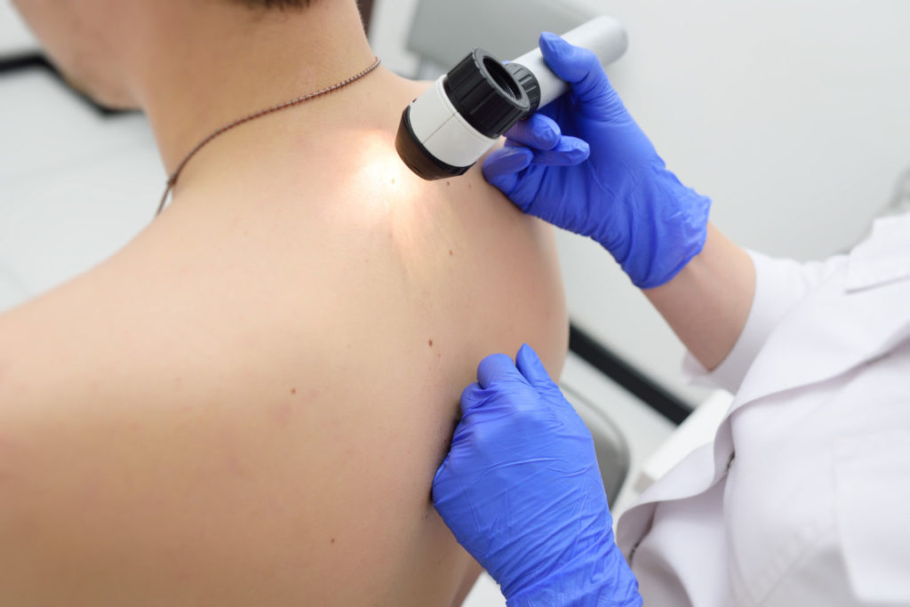 Skin Cancer Overview Summitmd Dermatology